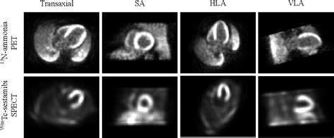 Figure 1 From A Multiscale Spatial Transformer U Net For Simultaneously Automatic Reorientation