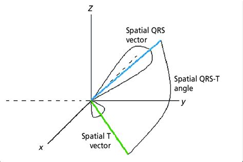 Spatial Qrs T Angle Is Shown Schematically Other Publication Download Scientific Diagram