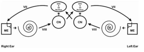 Acoustic Reflexes Flashcards Quizlet