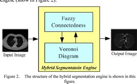 Figure 1 From A Hybrid Segmentation Approach Based On Fuzzy