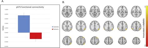 Seed Based Functional Connectivity Between Group Comparison Controls