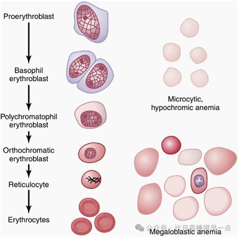 知识宝典 巨幼红细胞性贫血，你想知道的都在这里 知乎