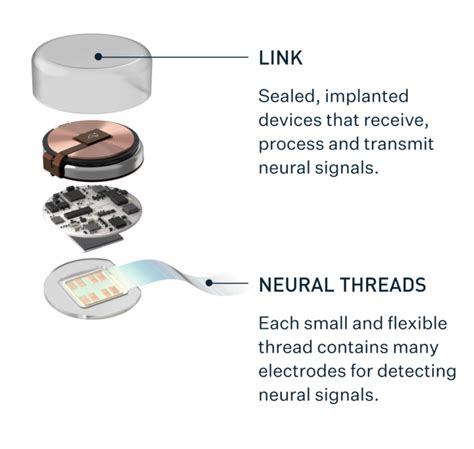 Neuralink Hirnimplantat Soll Gelähmten Menschen Bei Der Steuerung Von