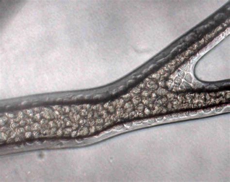 Microvascular Network Download Scientific Diagram