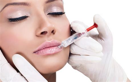 რა არის ფილერი და რამდენად უსაფრთხოა მისი გამოყენება ინტერვიუ „სკინ კოდის“ ექიმ კოსმეტოლოგთან