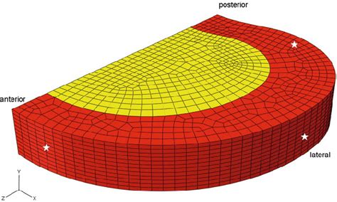 Finite Element Mesh Of 1 4 Of An Intervertebral Disc With Download Scientific Diagram