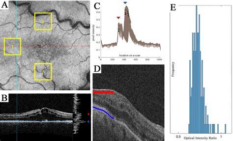 Visual Representation Of The Oir Semiautomated Algorithmic Analysis