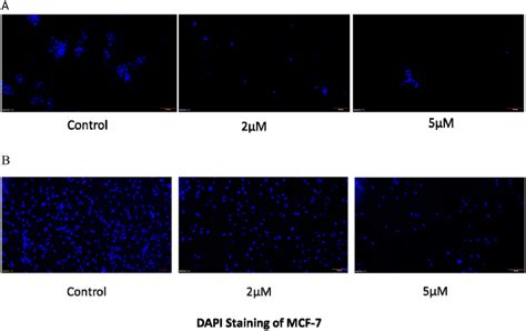 Nuclear Morphology Of Cancer Cells Was Seen By Dapi Staining Of