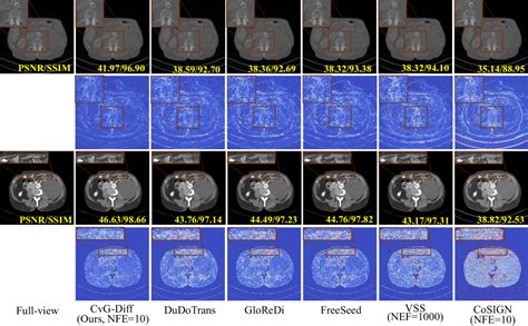 Cross View Generalized Diffusion Model For Sparse View Ct