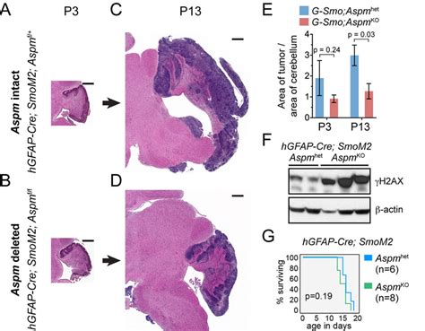 Figure 1 From Aspm Sustains Postnatal Cerebellar Neurogenesis And