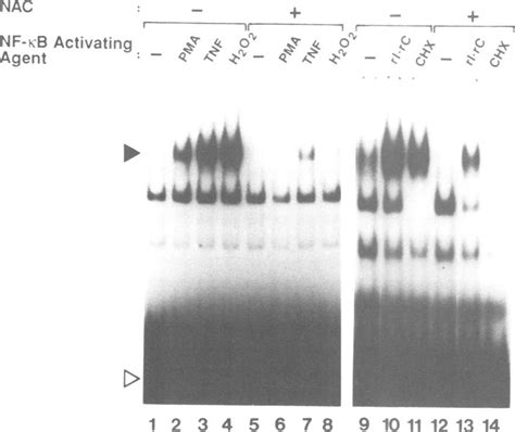 The Effect Of Nac On The Activation Of Nf Xb By Five Different Agents
