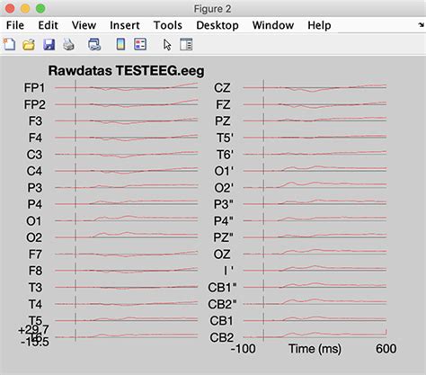 Two Decades Of Eeglab Eeglab Wiki