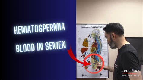 Hematospermia Blood In Semen Chiropractor Manhattan Hematospermia Blood In Semen Chiropractor Manhattan