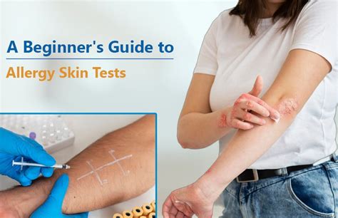 A Beginners Guide To Allergy Skin Tests