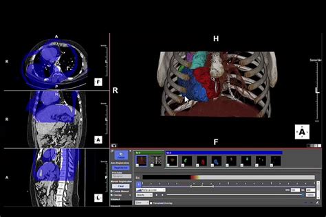 Stanford 3d And Quantitative Imaging Laboratory On Linkedin 3dimaging