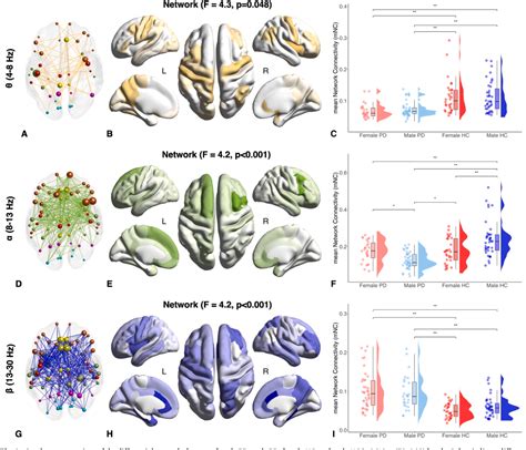 Figure 1 From Sex Hormones Shape Eeg Based Functional Connectivity In