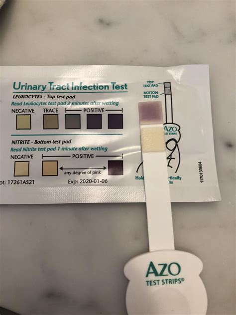 Does Anyone Elses UTI Test Look Like This When Theyre In A Flair R Interstitialcystitis