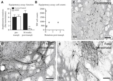 Human Esc Derived Dopamine Neurons Show Similar Preclinical Efficacy And Potency To Fetal