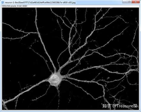 Imagej实用技巧——sholl Analysis（二） 插件篇 知乎