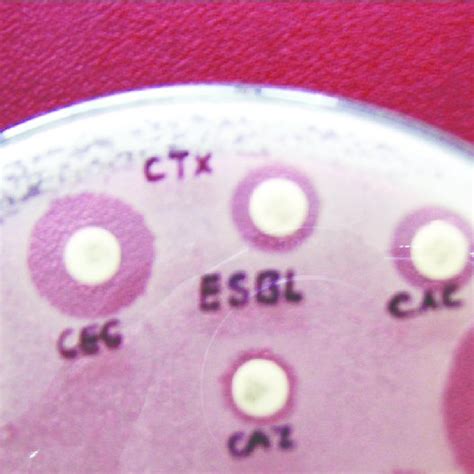 Esbl Confirmatory Test Download Scientific Diagram