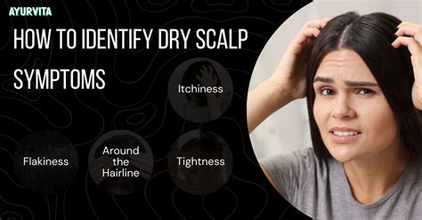 How To Remove Dryness From Scalp A Complete Guide Ayurvita