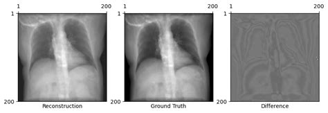 3D Reconstruction Diffdrr