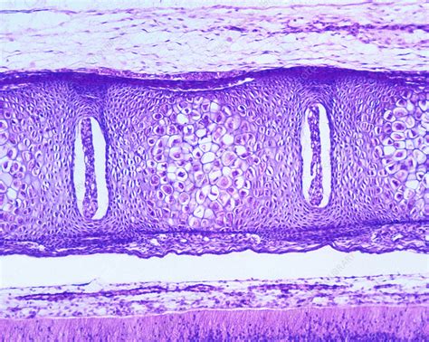 Developing Vertebrae Light Micrograph Stock Image C062 0272 Science Photo Library