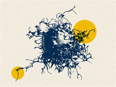 In 10 Seconds Ai Model Detects Cancerous Brain Tumor Often Missed During Surgery Michigan