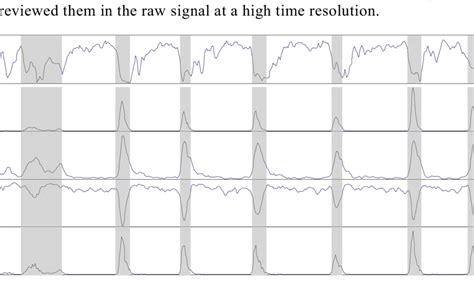The Five Feature Signals That Have Been Chosen For Bs Classification