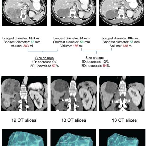 Size Based And Choi Criteria Different Size Based Criteria And Choi