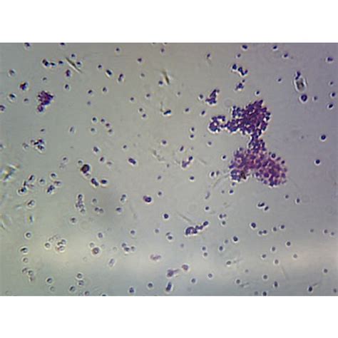 Prepared Microscope Slide Diplococci Neisseria And Enterococcus