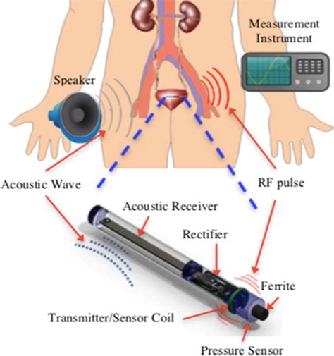 Implantable Sensors For Real Time Health Monitoring
