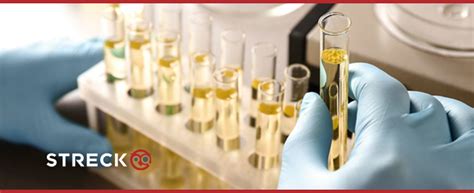 Streck Urine Preserve Abacus Dx