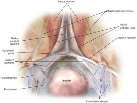 Laparoscopic Repair Of Atypical Hernias Suprapubic Subxiphoid And Lumbar Clinical Tree