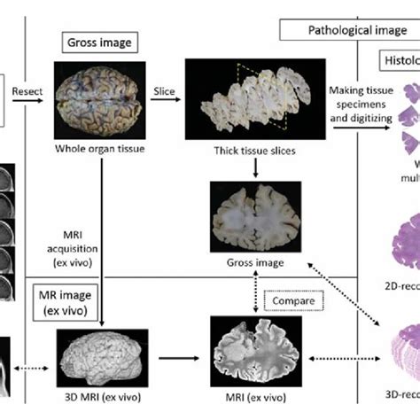 Overall Workflow Of The 3d Volume Histology Image Reconstruction Of The