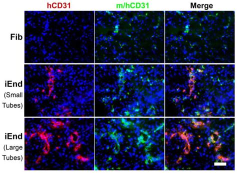 Conversion Of Human Fibroblasts To Functional Endothelial Cells By Defined Factors Abstract