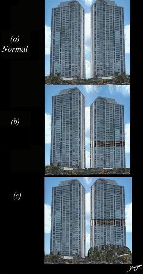Art Fx 1 Collapse Of Middle Floors Of Building 2 Compensatory Elevation Dx Discoid Atelectasis