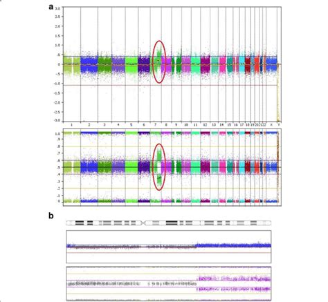 Snp Array Results Of The Proband A Full Genome View Of The Proband