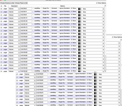 Create A 3d Model From A Series Of Dicom Images Support 3d Slicer