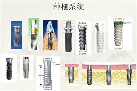 Iti种植工具盒图谱iti种植工具盒摆放图iti种植工具盒大山谷图库