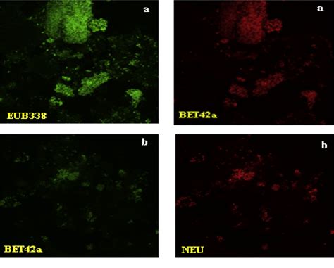 Two Step Partial Nitritationanammox Process In Granulation Reactors Start Up Operation And