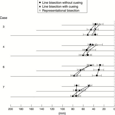 Line Bisection Test Printable The Time Taken To Complete The Test Is Recorded