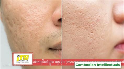 របស់ប្រើប្រាស់៣មុខនេះ បើមិនស្តាយលុយទិញប្រើចុះ Cambodian Intellectuals ចក្ខុវិស័យ គួច ម៉េងលី