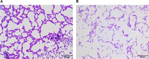 Lactobacillus Under Microscope