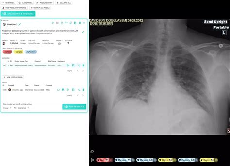 Annotator Product Mdai