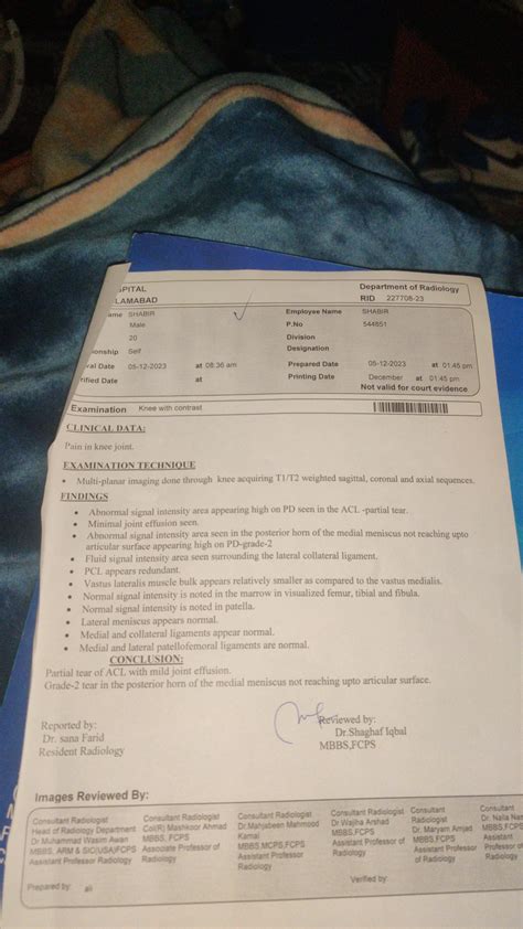 Acl Partial Tear R Acl