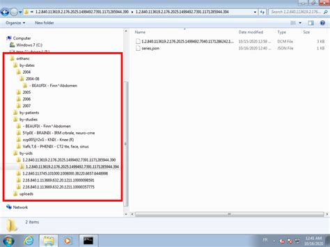 How To Open Dicomdir File In Matlab Bpopublishing