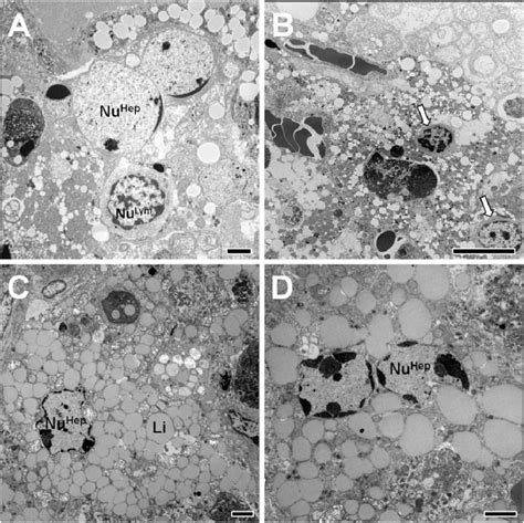 Inflammatory Mononuclear White Blood Cells Morphologically Consistent