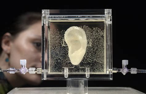 Vincent Van Gogh Ear Story