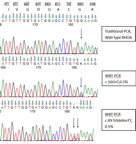 Wild Type Blocking Pcr Combined With Sanger Sequencing For Detection Of Low Frequency Somatic